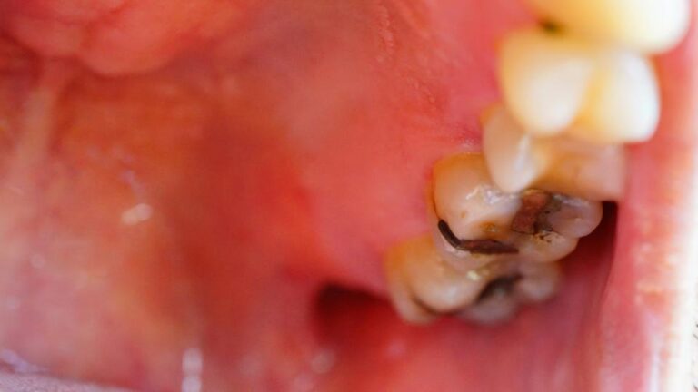 Amalgam Waste: How to Deal with it Correctly | Waste Managed